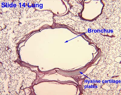 Lung Slide Labeled Bronchiole